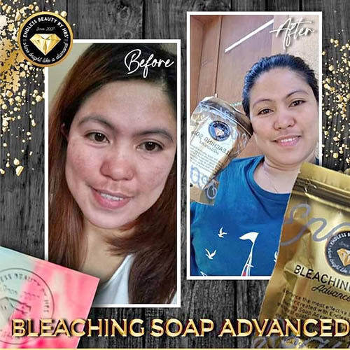 HBS BLEACHING SOAP ADVANCE| WHITENING SOAP | Lazada PH