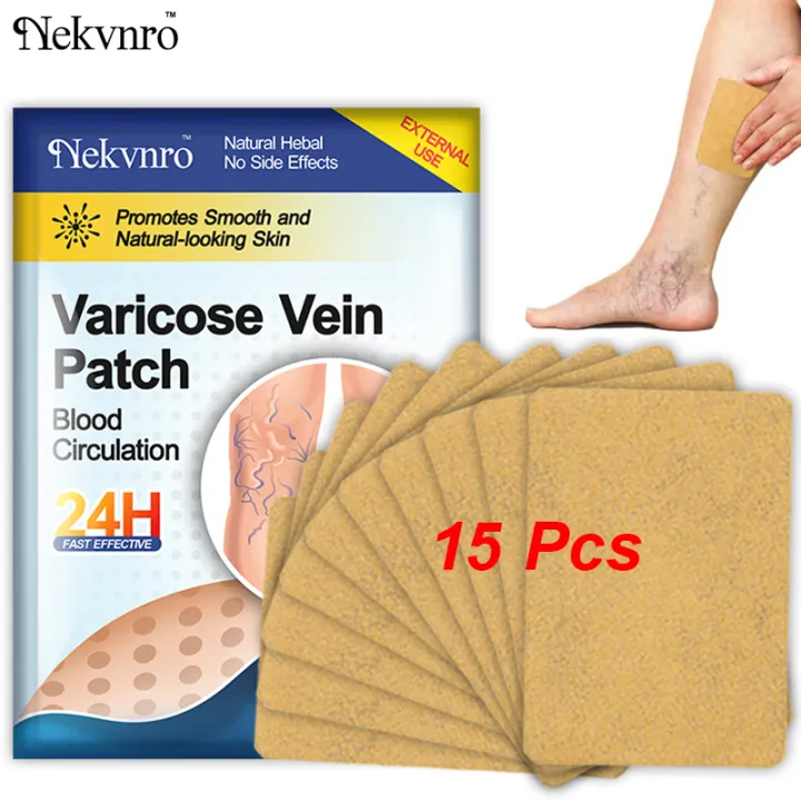 Nekvnro 15Pcs Herbal Varicose Veins Treatment Patch 100% Original ...