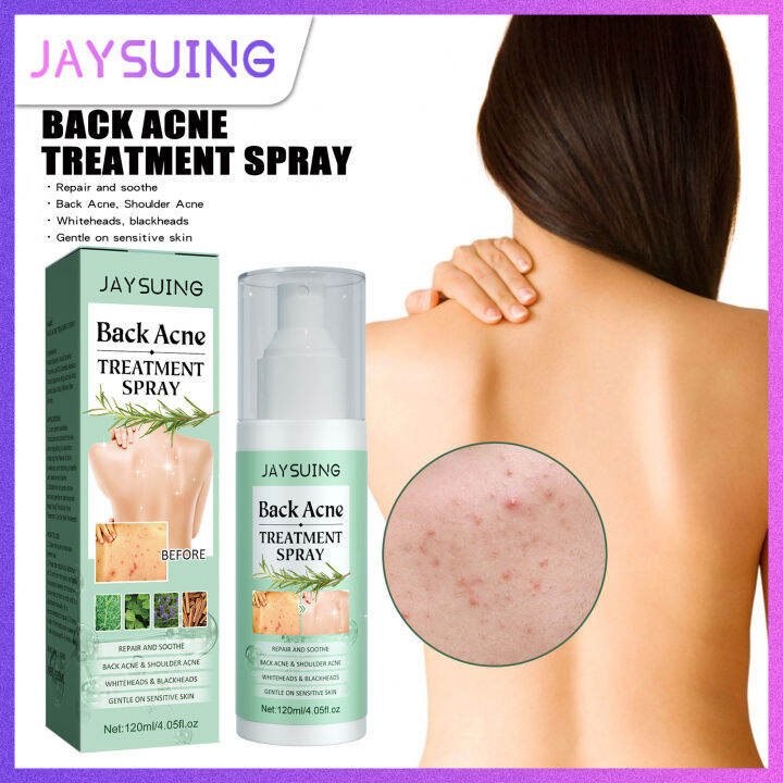 Jaysuing Back Acne Treatment Spray Anti Acne Marks Spot Removal Serum