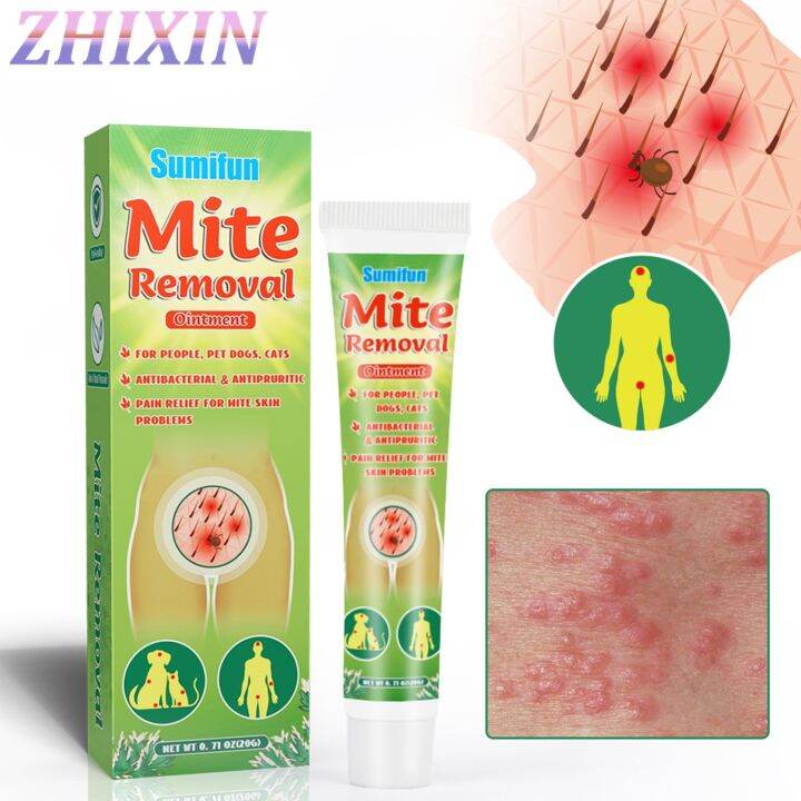Zhixin 20g Mite Removal Cream Non-Pungent Anti-Itch External Use ...