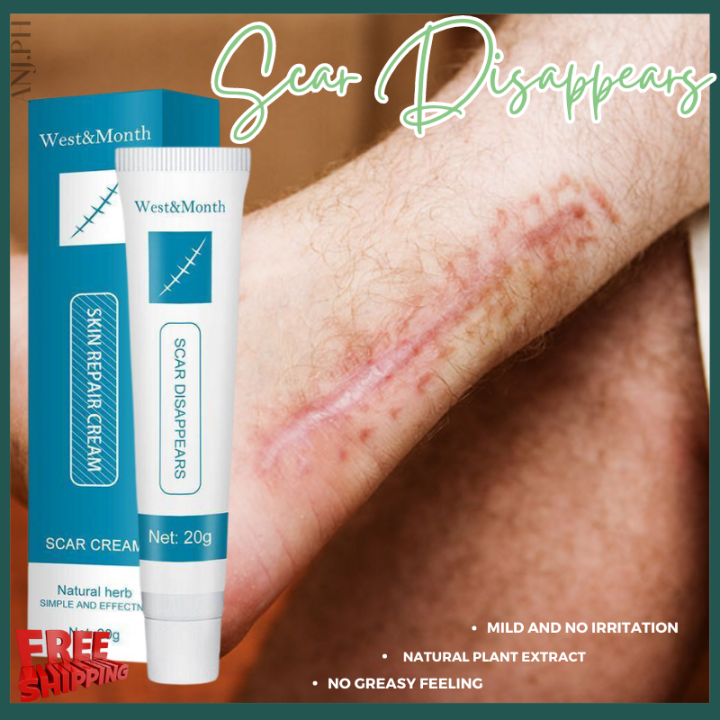 SUPER TRENDING West&Month Scar Disappears Scar Cream Stretch Marks ...