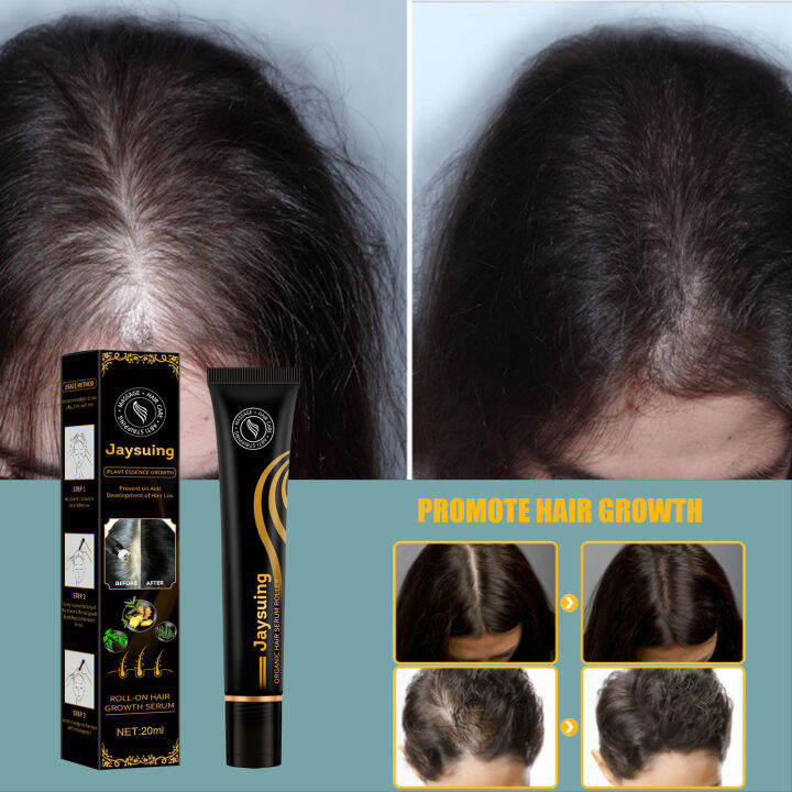 Hair ball massage liquid anti-stripping nourishing hair thick anti-hair ...