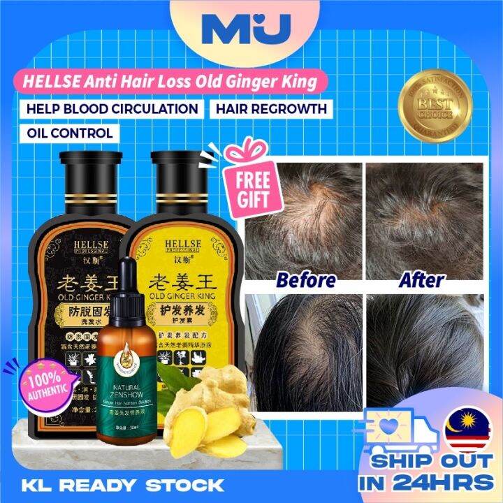 PROMO MIJOO HELLSE Old Ginger King Anti Hair Loss Treatment Shampoo ...