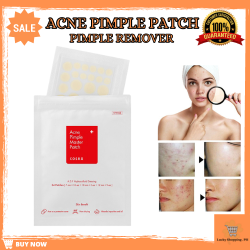 Pimple Patch Stickers Acne Pimple Remover Tool Absorb Pus And Oil Acne ...
