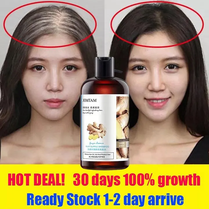 Original Ginger Shampoo Fast Powerful Hair Growth Shampoo Anti Hair ... Original Ginger Shampoo Fast Powerful Hair Growth Shampoo Anti Hair ...