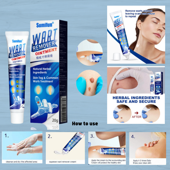 SUMIFUN Warts Remover Original Cream 20g Warts Magic Remover Wartz ...