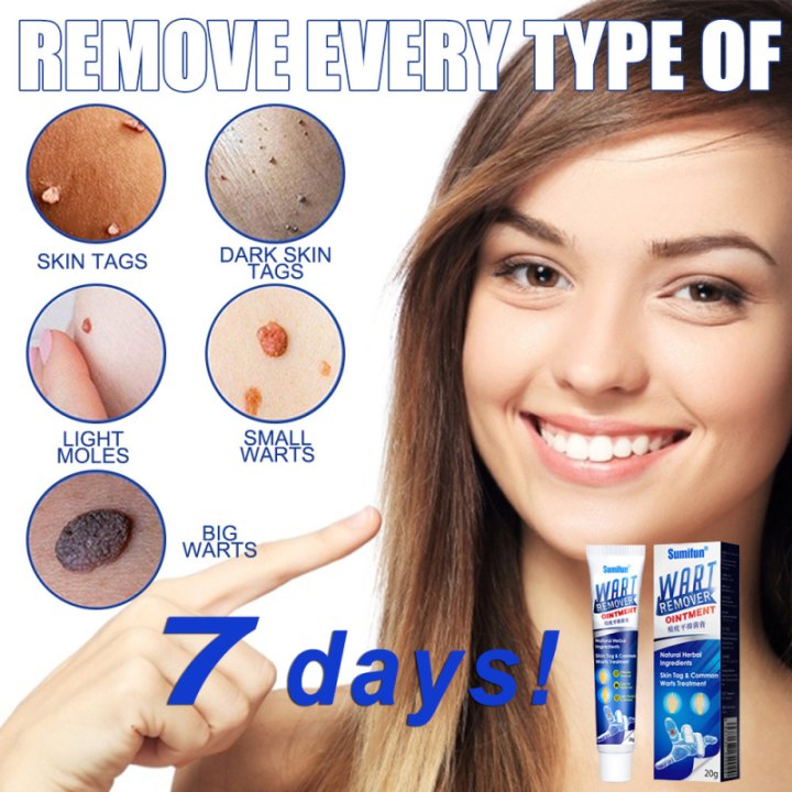 A Super Store Original SUMIFUN Warts Remover Original Cream 20g Warts ...