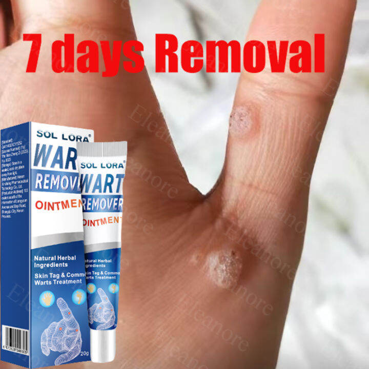 Warts Remover Original Cream 20g Skin Kulugo Remover Skin Growth ...