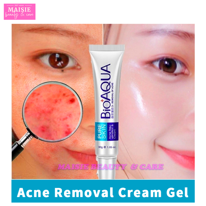 BIOAQUA PURE SKIN Acne Scar Removal Rejuvenation Cream EFFECTIVE ACNE ...