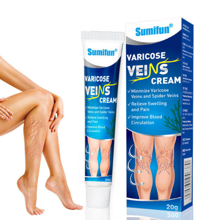 Varicose Veins Remover Treatment Cream Spider Vein Pain Varicosity ...