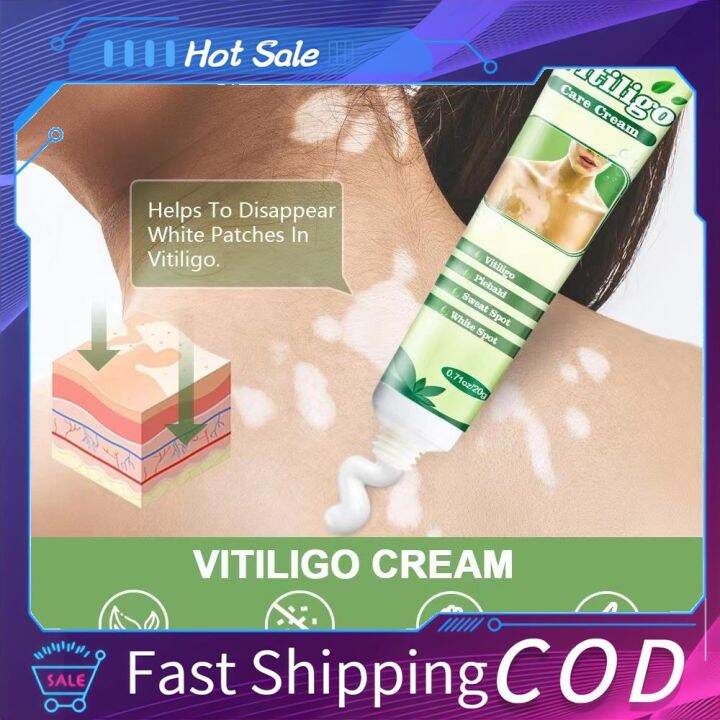 【🥇COD】 Vitiligo Treatment Spots Remover Ointment Supplies | Lazada PH