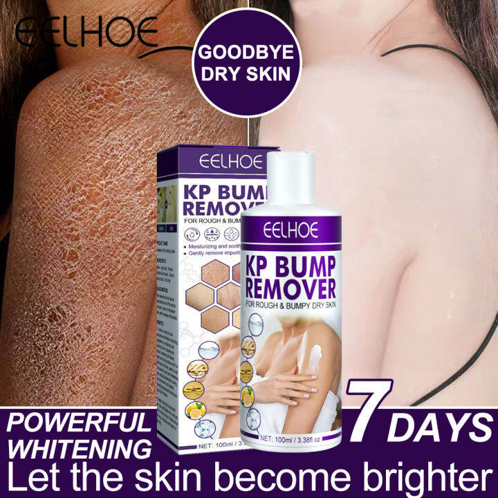 Eelhoe Keratosis Pilaris Repair Cream Chicken Skin Body Lotion Skin