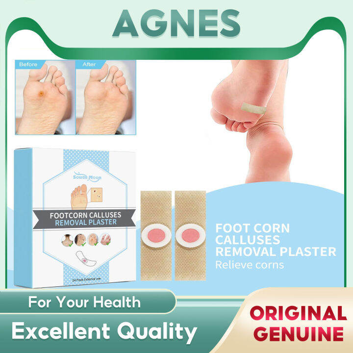 South Moon Foot Corn Calluses Removal Plaster Calluses Medical Plaster ...