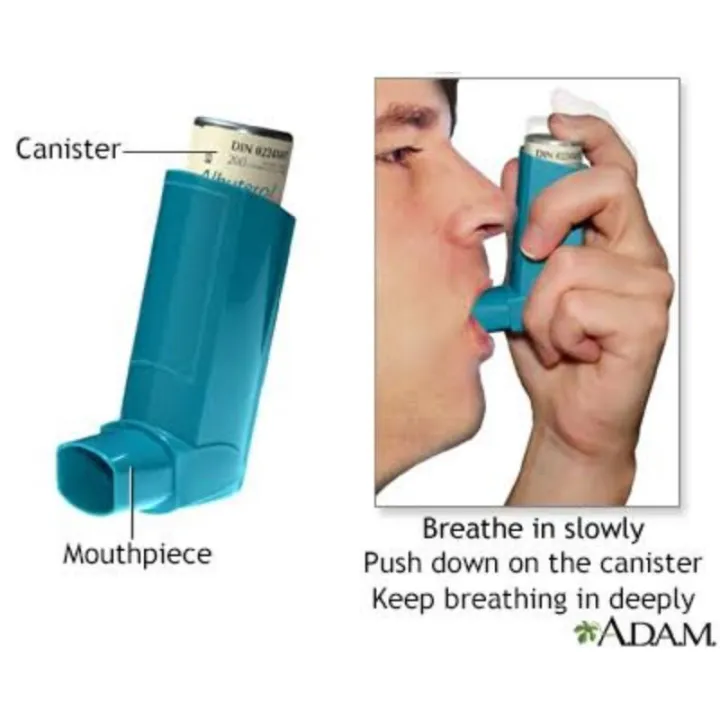 Explosive models ※inhaler for asthma-- salbu spray♬ | Lazada PH