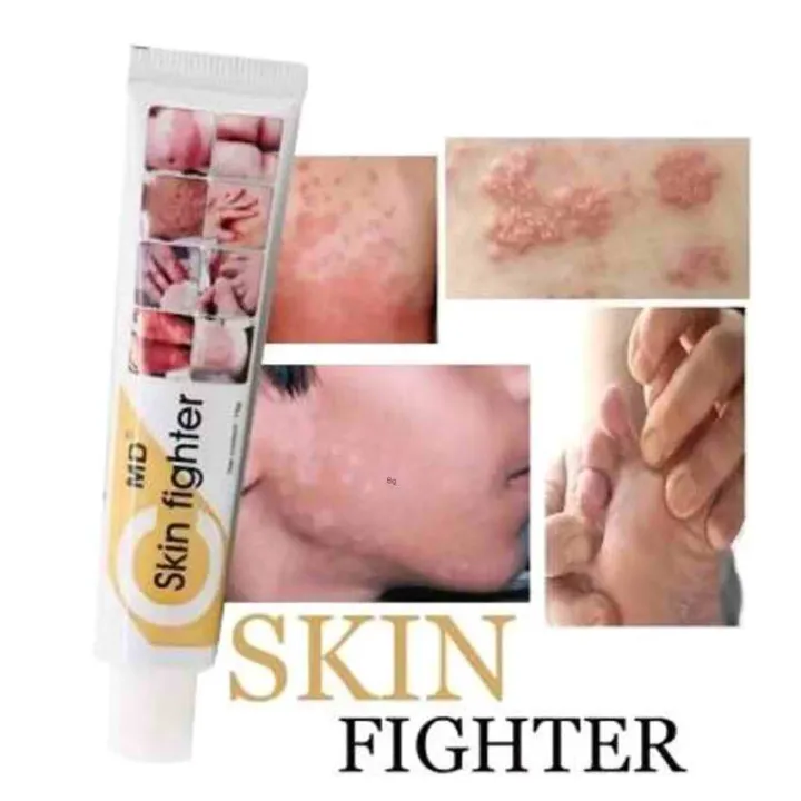 ws shop Original MD Skin Fighter Cream for Skin Allergies or Fungis ...