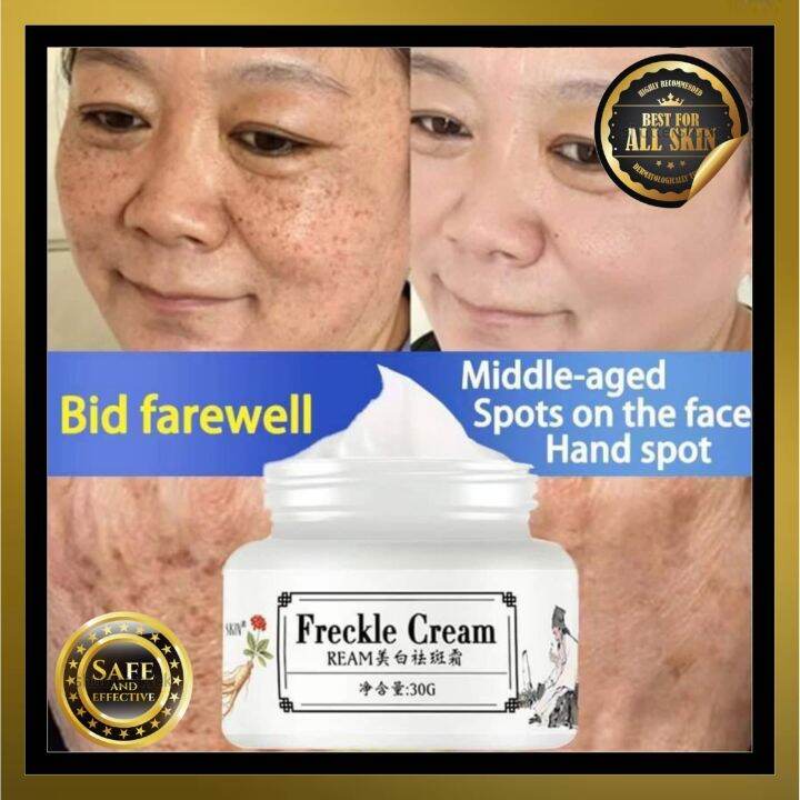 Original and Effective melasma and dark spot remover whipped cream anti melasma cream face cream ...
