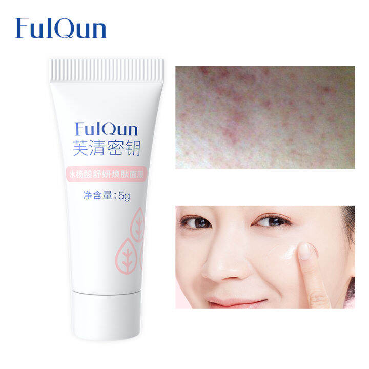FulQun Salicylic กรดพอกหน้ารักษาสิว B Lackhead ซ่อมควบคุมน้ำมันหดรูขุม ...