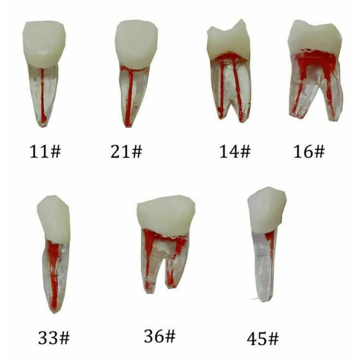 ENDODONTIC TEETH MODEL (ACE) sold per piece / Tooth / Roots | Lazada PH