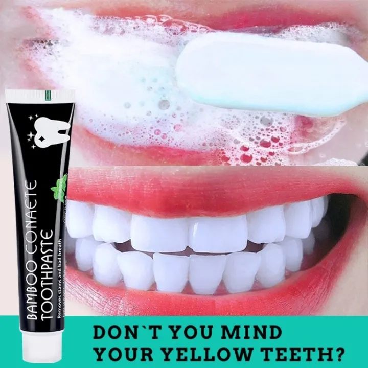 [Hot sales] Teeth Toothpaste/Pen/Mousse Tooth Whitener Paste | Lazada PH