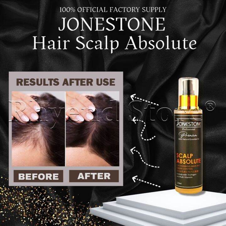 JONESTONE SCALP ABSOLUTE HAIR TONIC 120ML | Lazada Indonesia