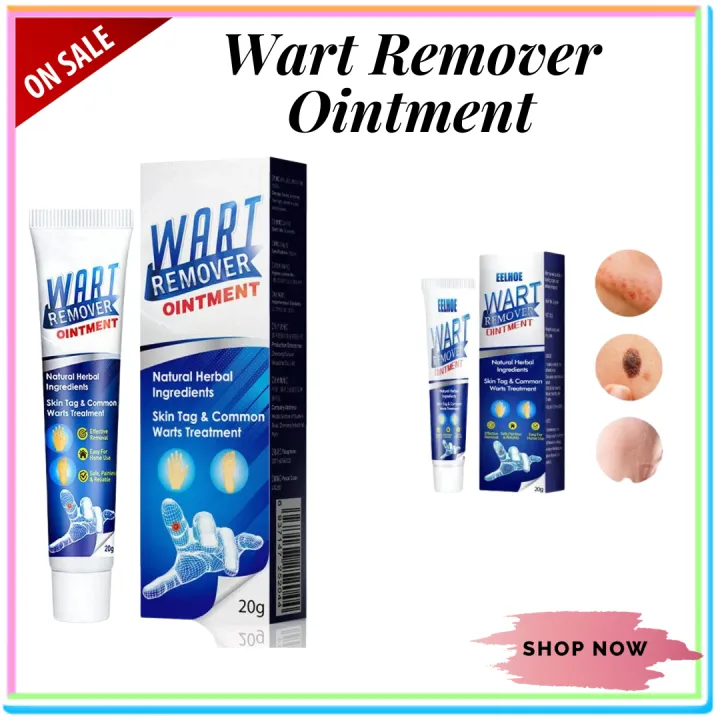 100% Very Effective WART REMOVAL- 【EELHOE】Warts Remover Original Cream ...