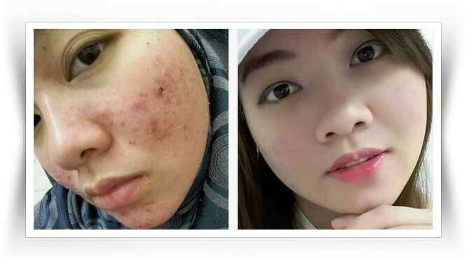 LUXXE WHITE GLUTATHIONE 775mg 60 Capsules | Lazada PH