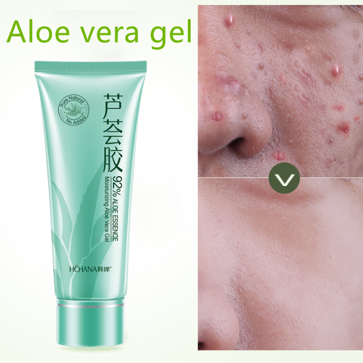 Aloe vera gel 92% aloe extract Anti-acne removes acne Moisturizing ...