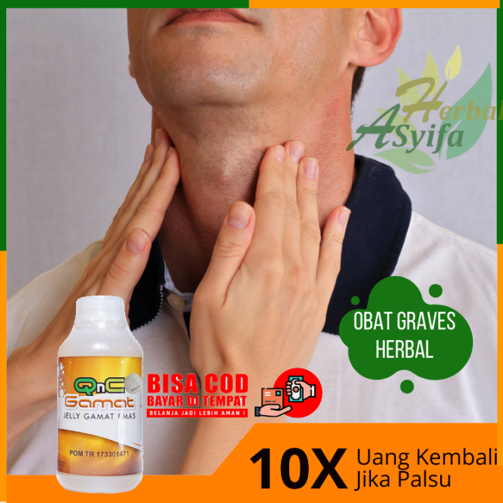 Obat Penyakit Graves - Tiroid Berlebih - Hipertiroidisme - Gondok ...