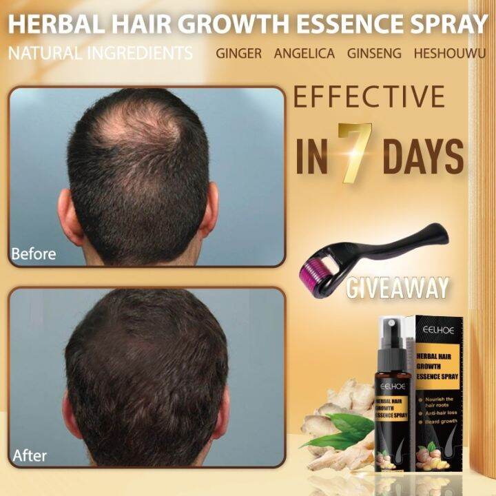 【cod】 Minoxidil Hair Grower Original Shampoo Growth Serum Grower For