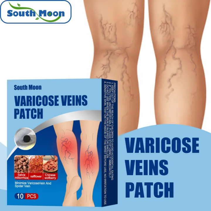 South Moon Varicose Veins Patch Varicose Veins Remover For Legs Patch ...