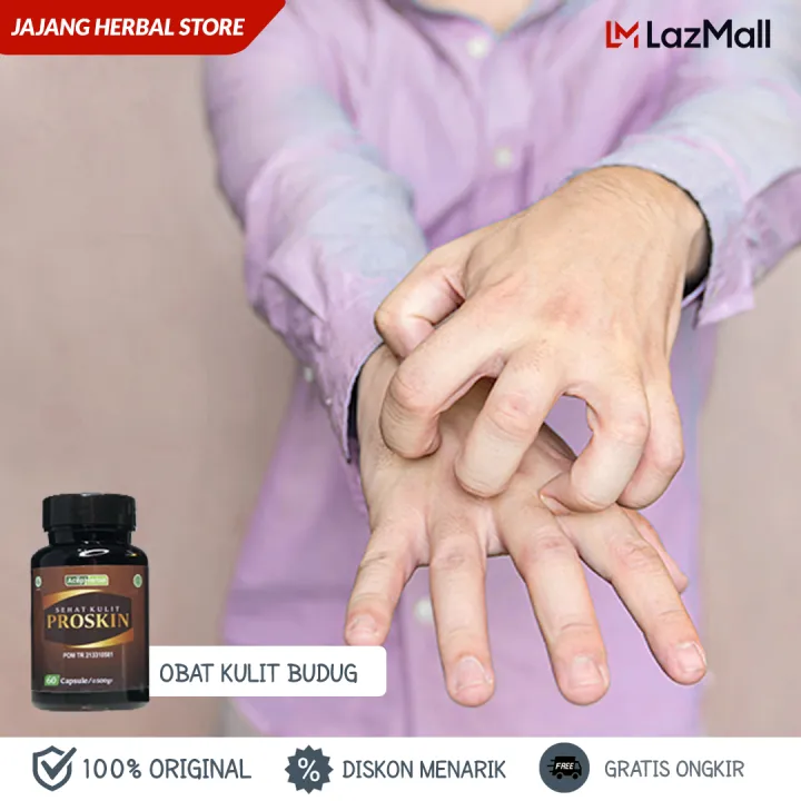 Obat Penyakit Budug Gatal Gatel Badan Scabies Bintik Merah Biduran ...