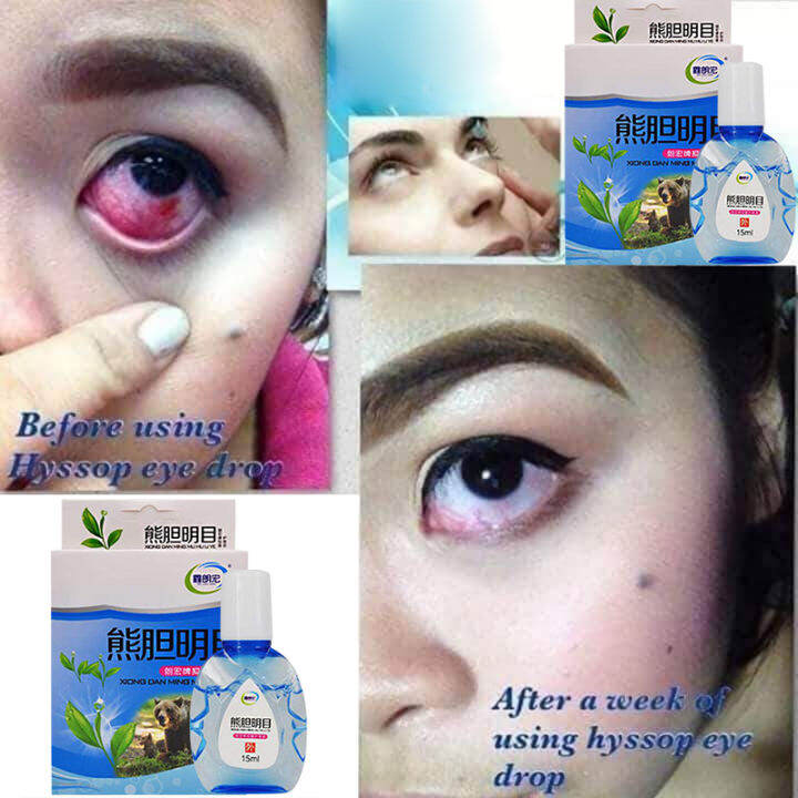 blueberry eye drops from japan japanese eye drops for dry eyes eyedrops ...