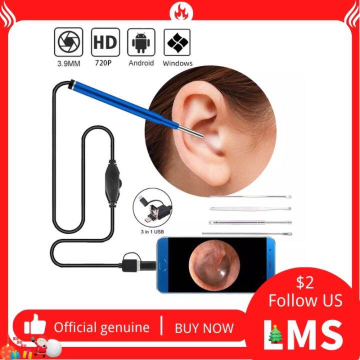 【CW】 3.9mm Otoscope USB Ear Endoscope Camera Type C Ent Nose Inspect ...
