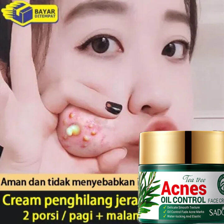 Repair Acne Brightening Cream Acne Scar Spots Cleaning Cream Shrink ...