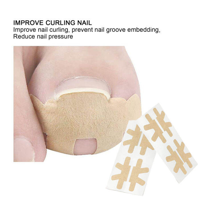 Professional Embedded Toe Nail Corrector Sticker Ingrown Toenail Care ...