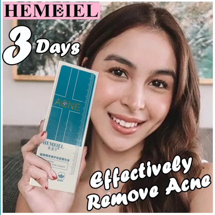 HEMEIEL Pimple Marks Remover/Best Seller Skin Care Product for Face ...
