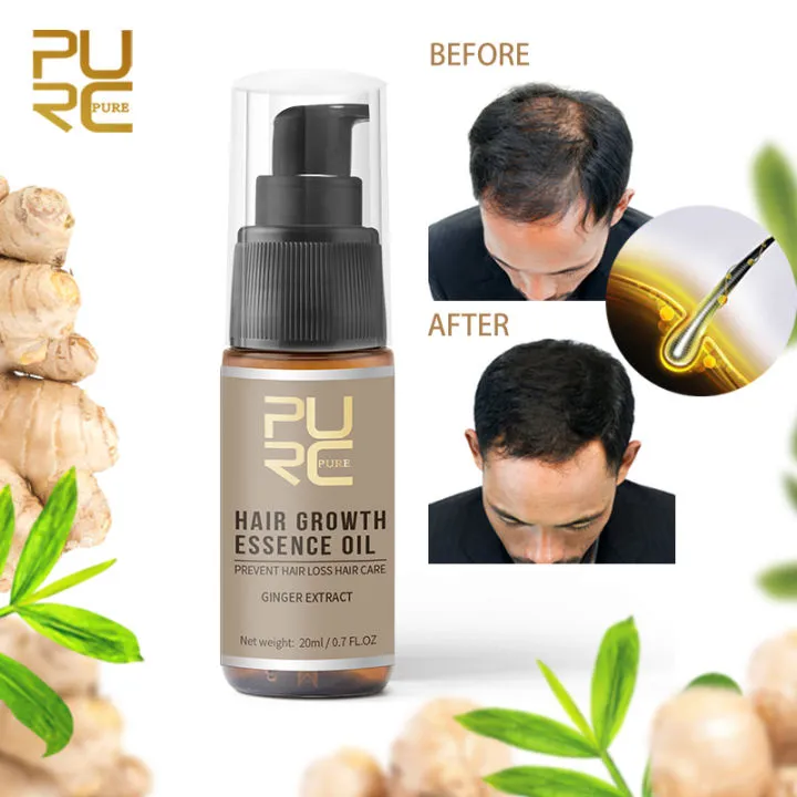 Purc 100 Pure Natural Hair Growth Oil Ginger Hair Treatment มี