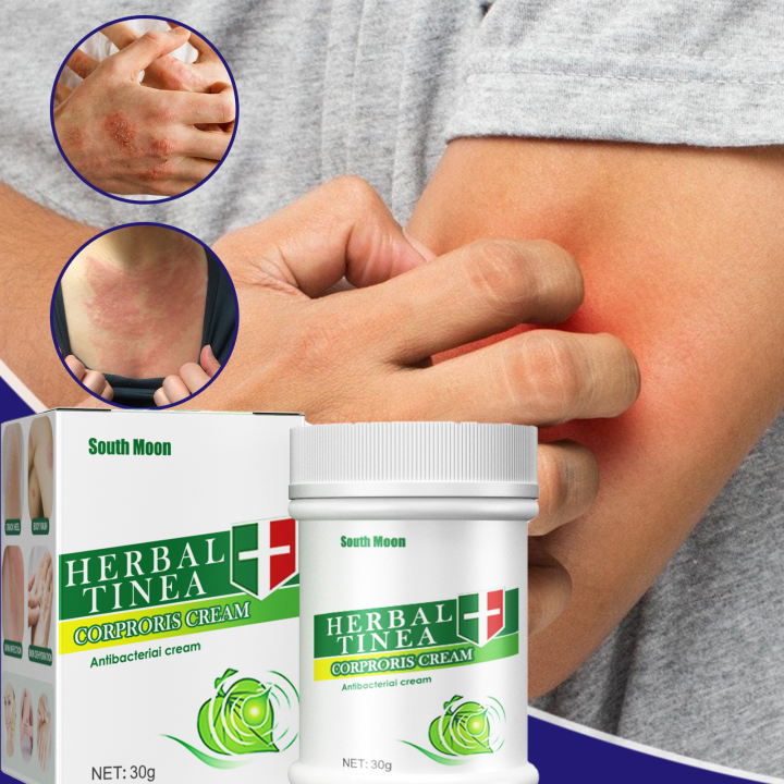 South Moon Anti-bacterial Cream Itchy Skin Allergy Cream 30g Itch ...