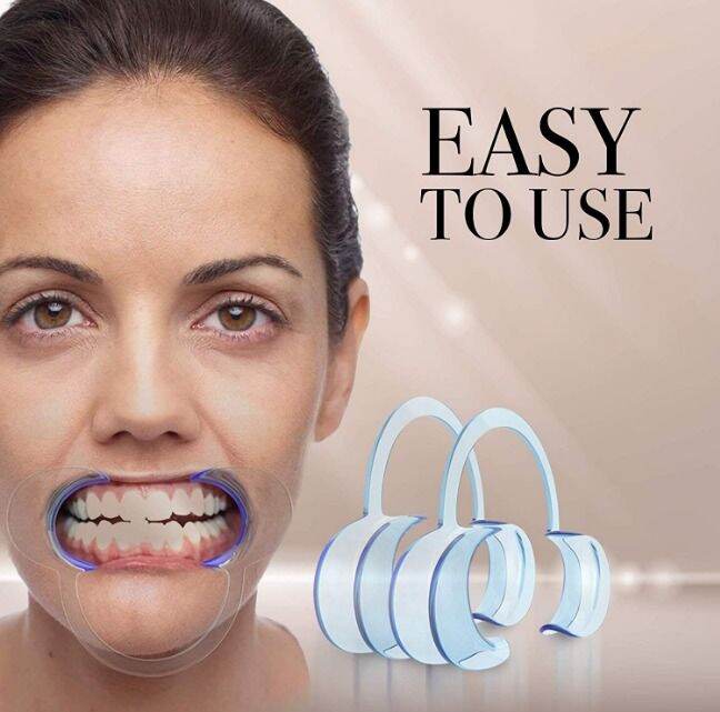 Opening tool mouth/mouth gate/Retractors/retractor/dentist tools snap ...