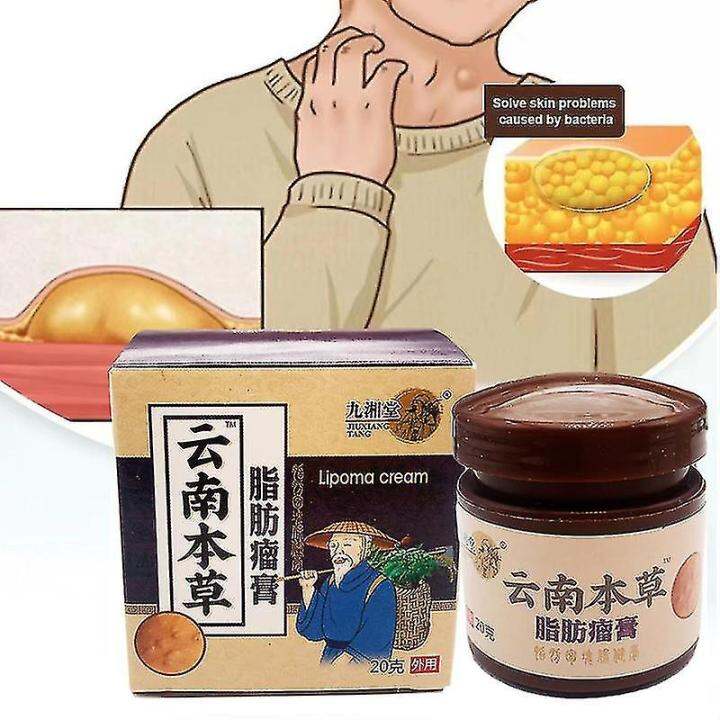 [ORIGINAL] Herbal Lipoma Removal Cream 20g Eliminate lipomas in 7 days ...