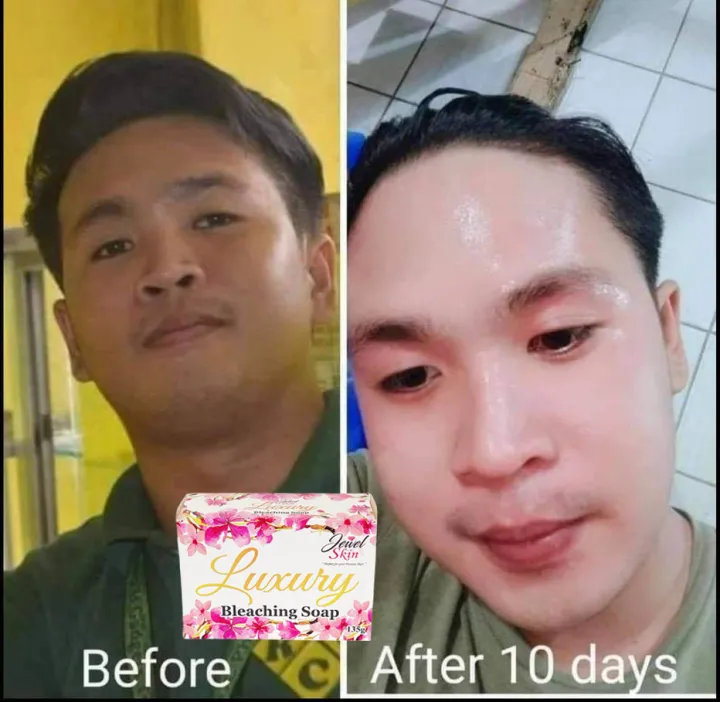 Jewel Skin Luxury Bleaching Soap | Ultra Bleaching Intensive Skin ...