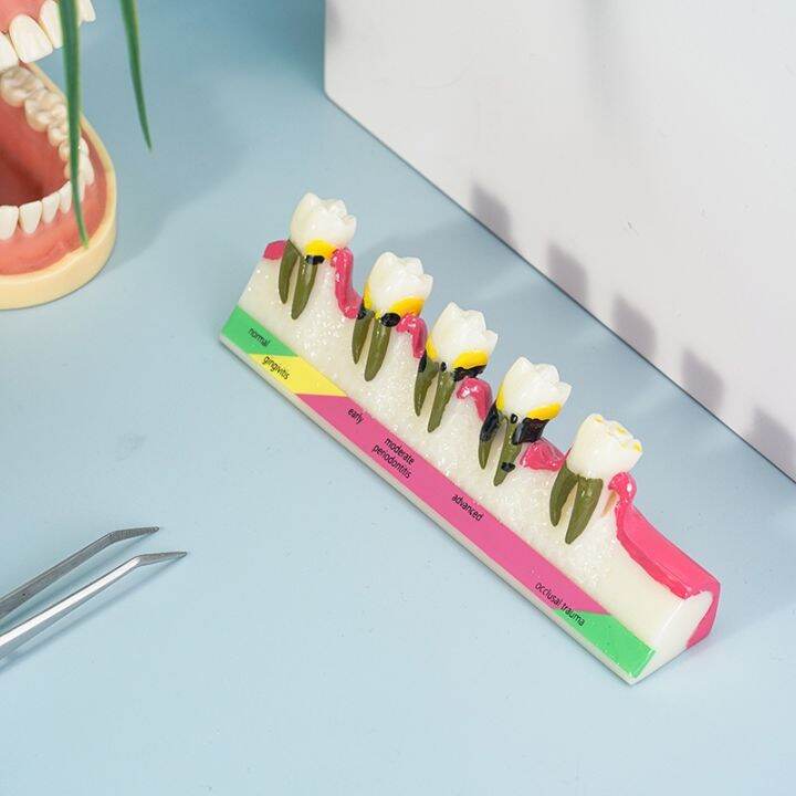 Dental Periodontal Model Tooth Study Teaching Model for School /Lab ...