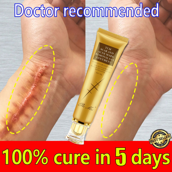 100% Effective fix scar removal Cream original scars remover for old ...