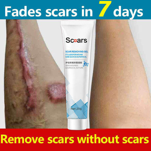 Beauty Scar Vanisher 20g for Stretch Marks Scar remover Cream for old ...