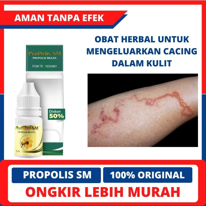 Obat Cacing Larva Pasir, Cacing Dalam Kulit, Cacing Masuk Ke Kulit ...