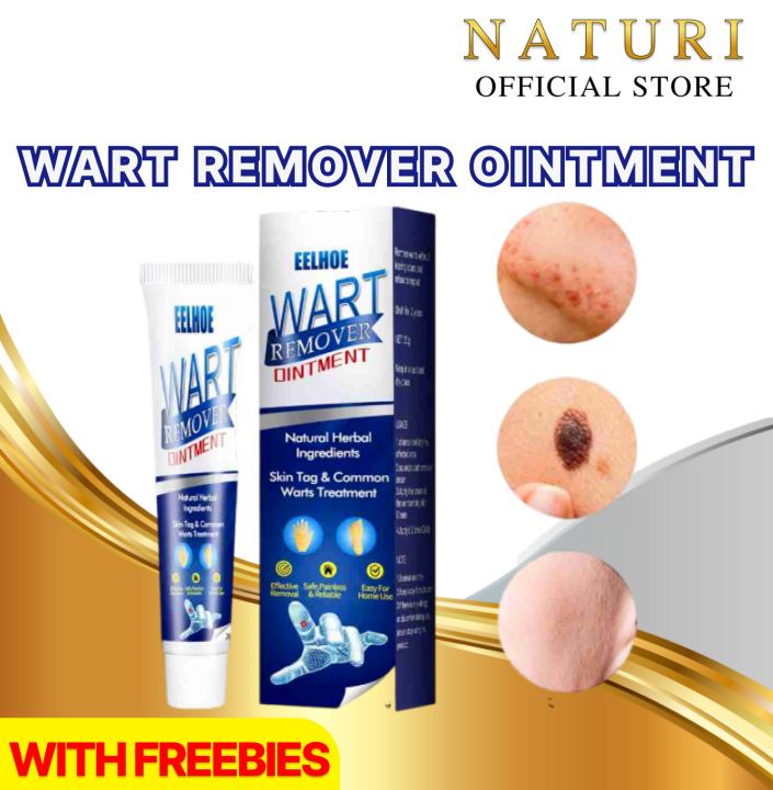 BEST SELLER Warts Remover Original Cream 20g Warts Magic Remover Wartz ...