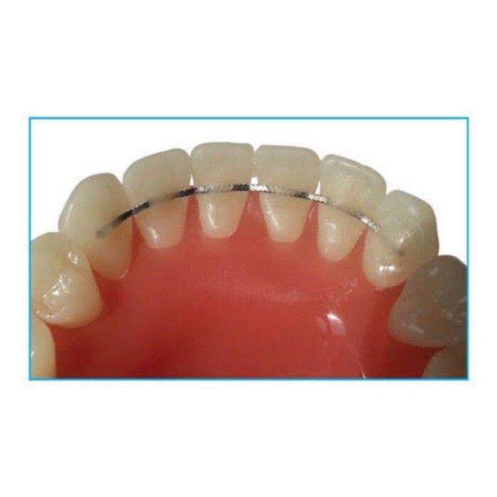 Alice dental // Lingual retainer FDA kawat gigi retainer palatal cekat ...