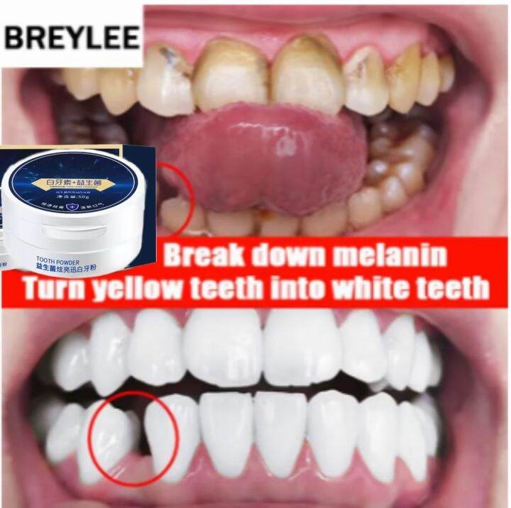 Natural Pearl WhiteningTeeth Whitening Powder/Whitening Tooth Powder ...