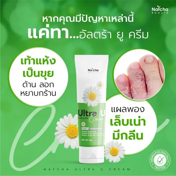 (ส่งฟรี)อัลตร้า ยู ครีมทาผิว ultra u cream 390.- หลอดขนาด 30 g. ผิวแห้ง แตก หยาบ สาก กลาก ...