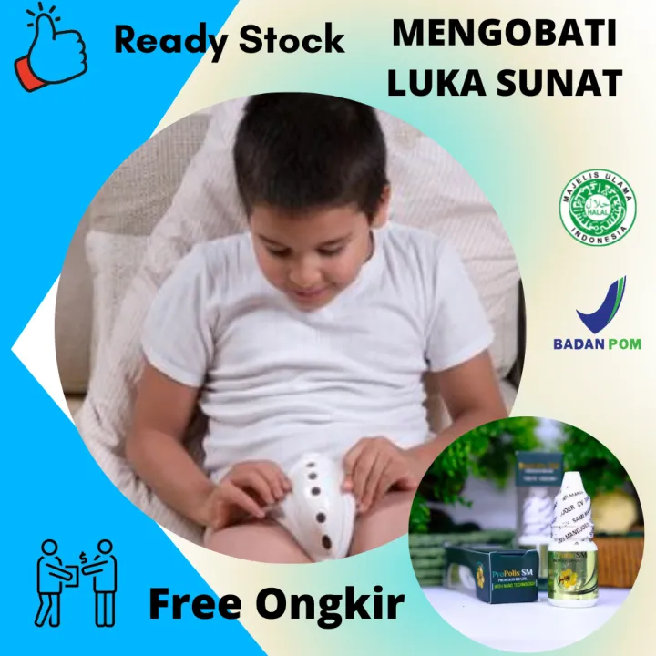 Obat Pengering Luka Sunat, Luka Basah Berair Susah Kering, Salep ...